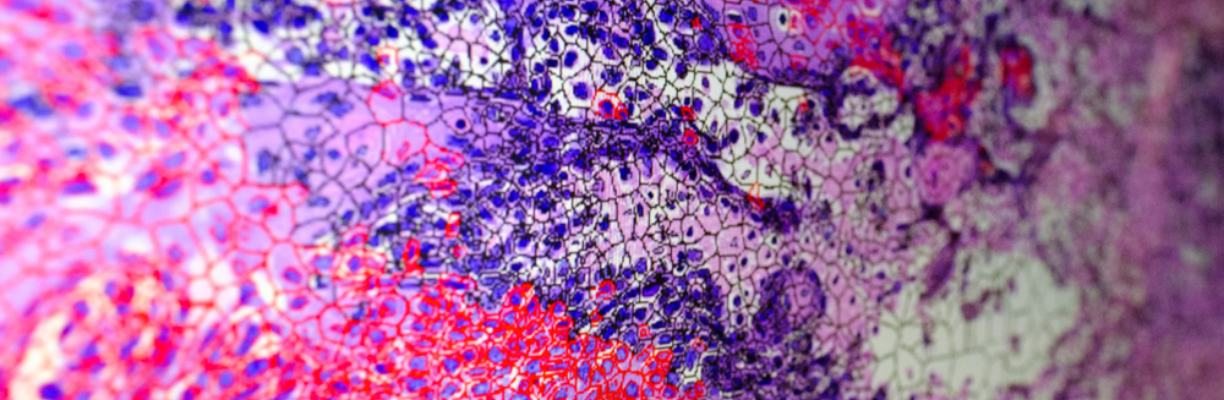 AI for affordable cervical cancer screening