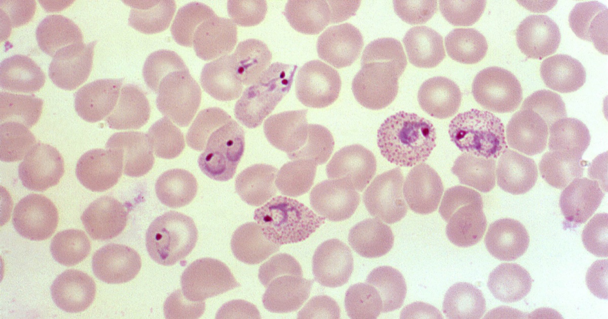 IIT-Bombay creates an AI model to diagnose malaria