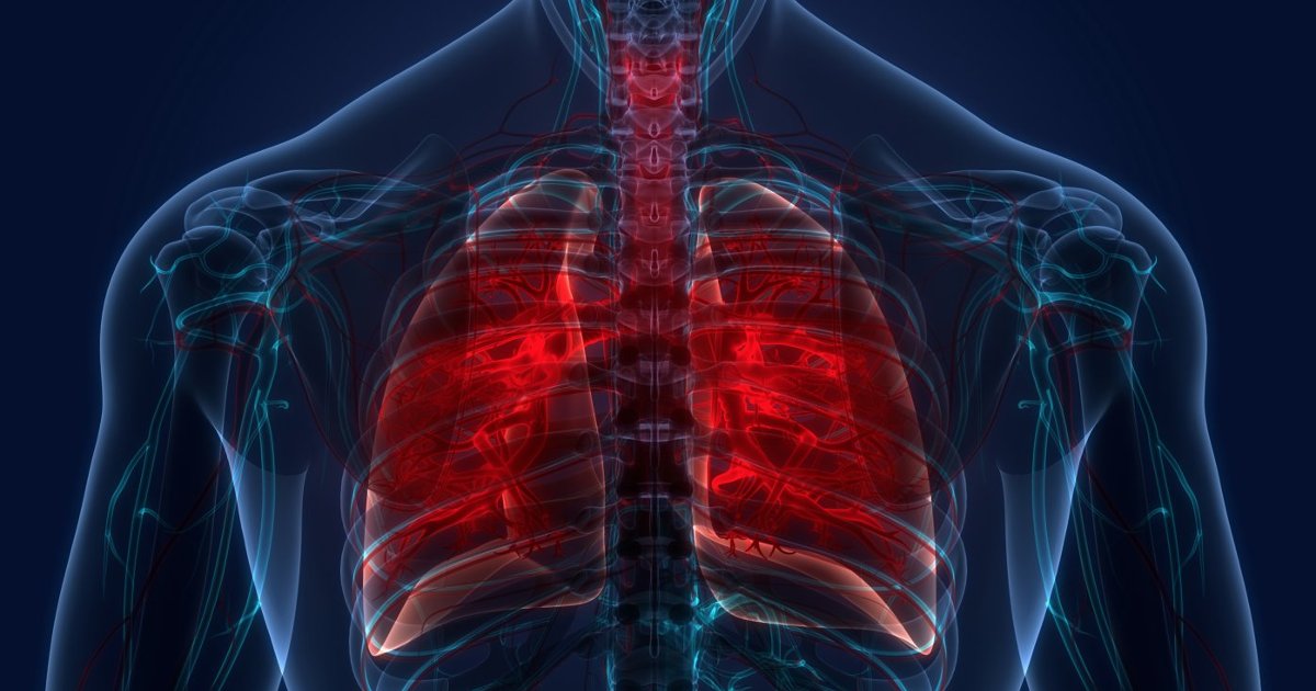 This AI software detects Tuberculosis in asymptomatic patients in the ... This AI software detects Tuberculosis in asymptomatic patients in the ...